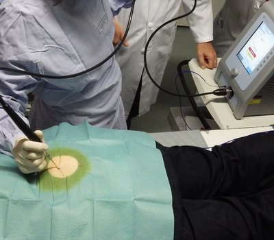 C3 CRYOSYSTEM - INFINITY MEDICAL